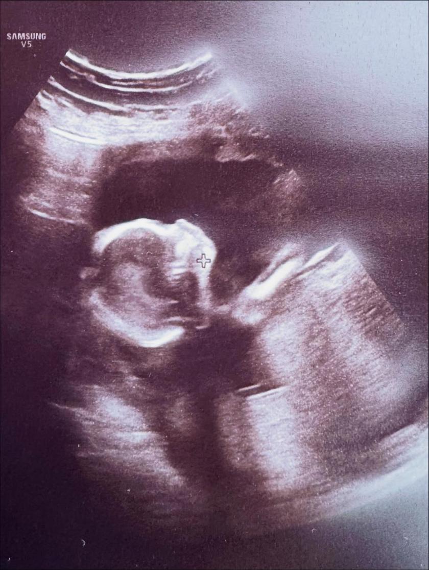 Linda Kraan uit Een huis vol emigreert in verwachting van tiende kind: ‘Zo blij, een klein ...